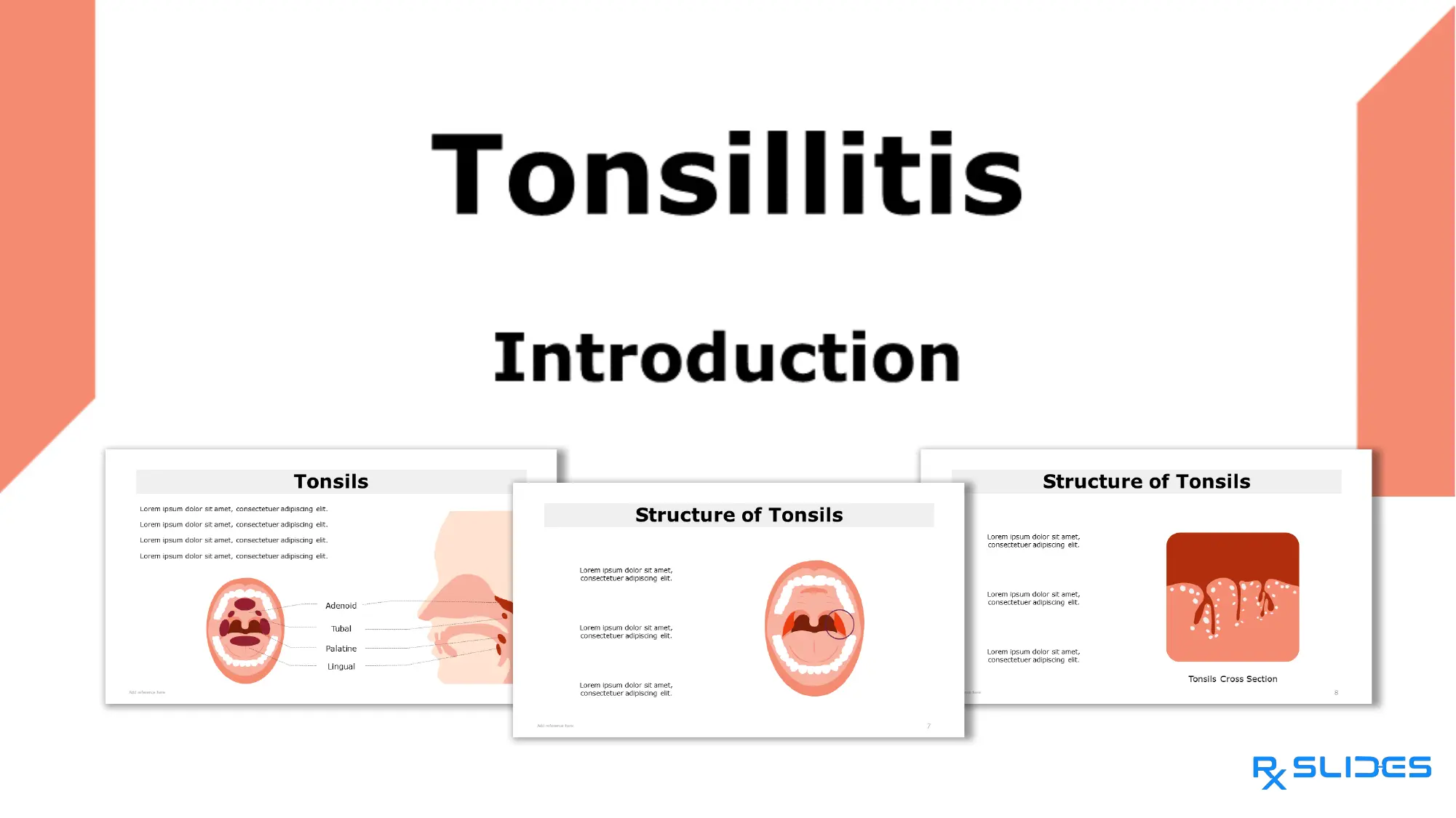 Download Tonsillitis PowerPoint Template| RxSlides